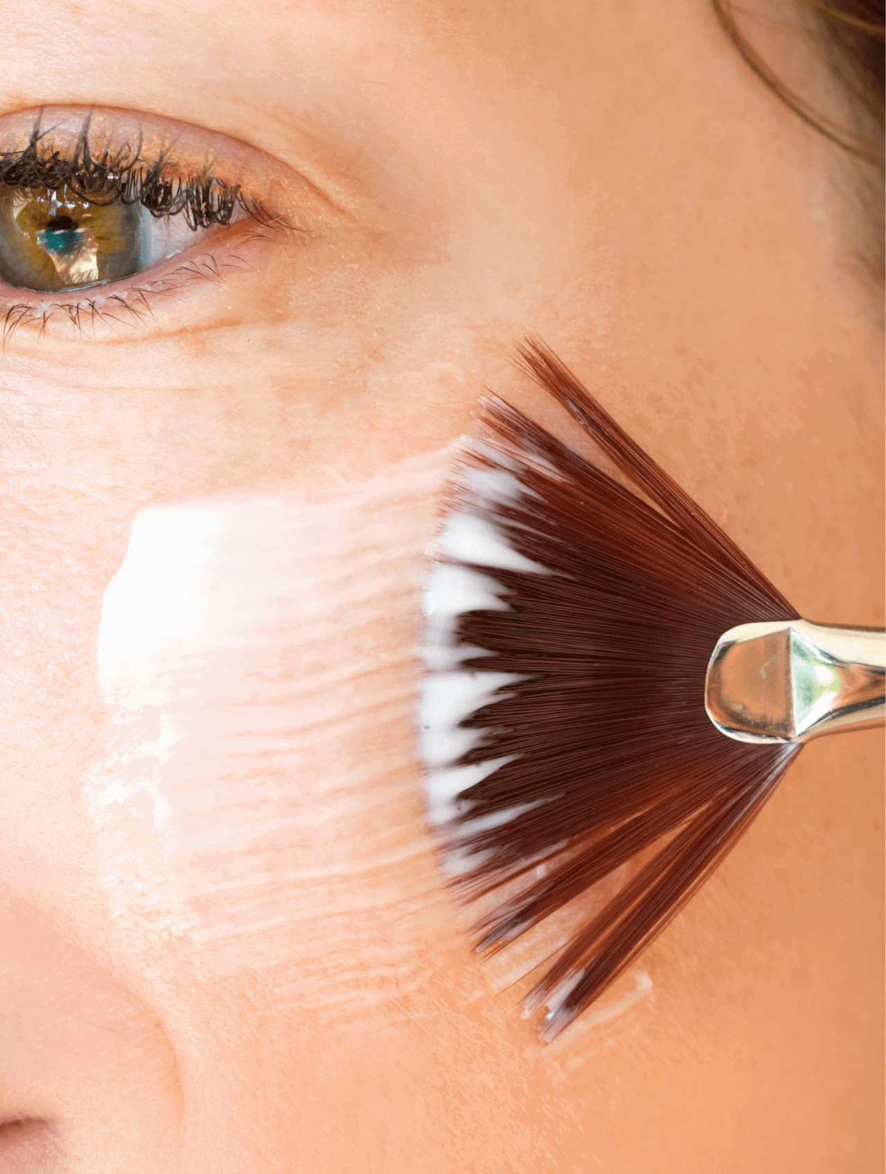 SKIN PEELS - Roundhay Aesthetics - LEEDS